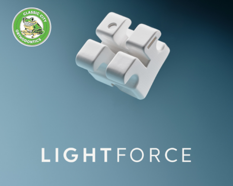 LightForce vs. Traditional Braces: A Head-to-Head Comparison - Classic ...